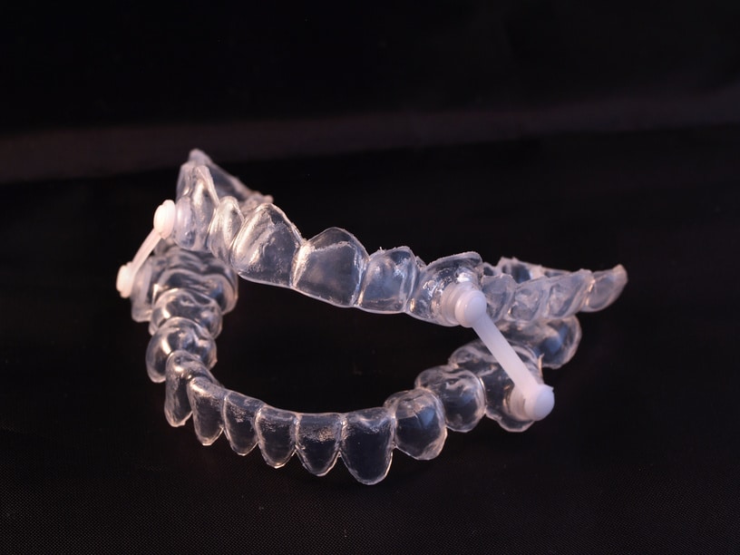 Oral Appliance Therapy: An Introduction - Sleep Dynamics